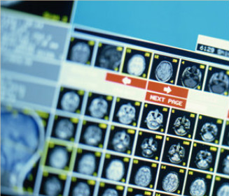 MRI